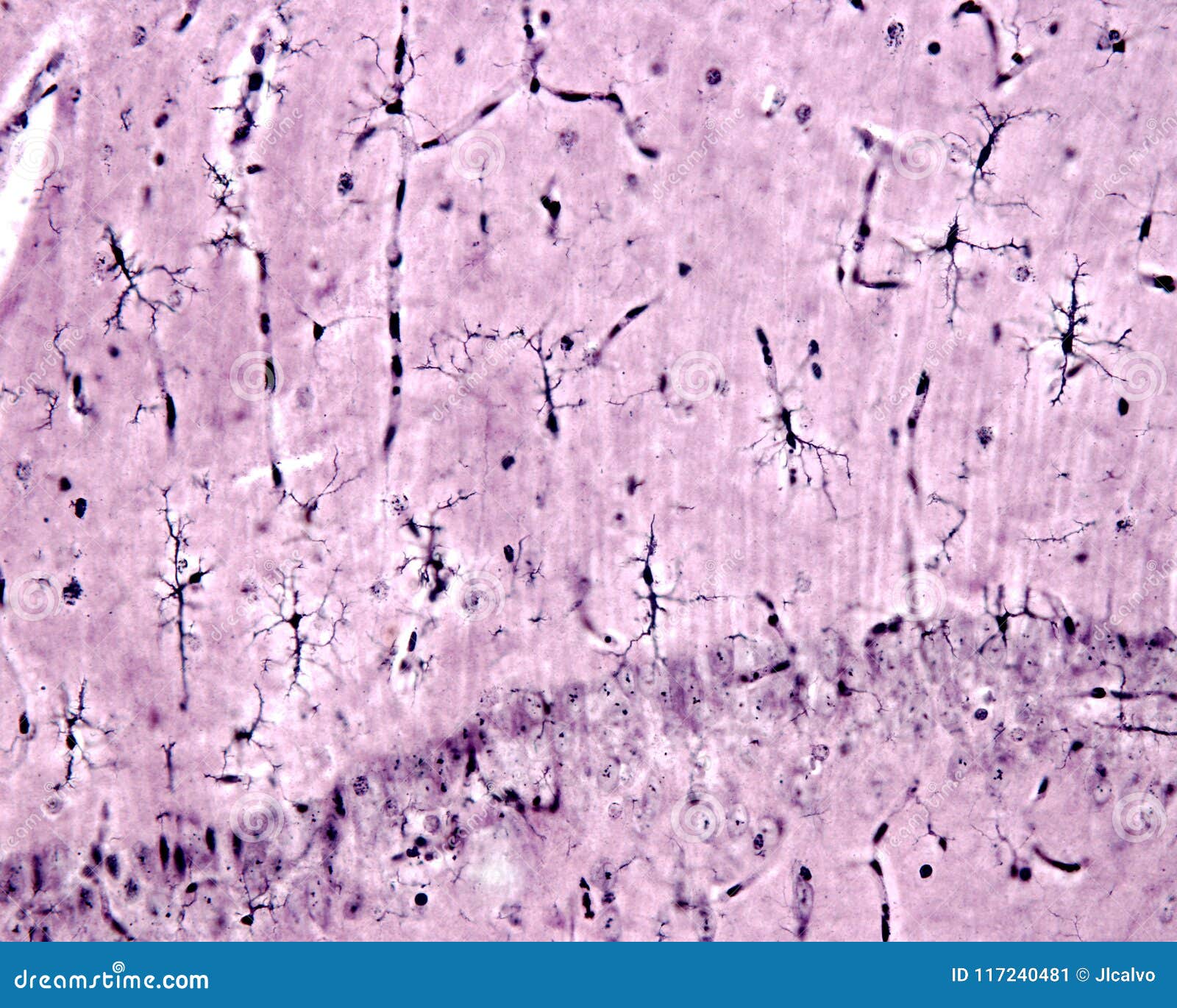 Microglia Hipocampo imagem de stock. Imagem de biologia - 117240481
