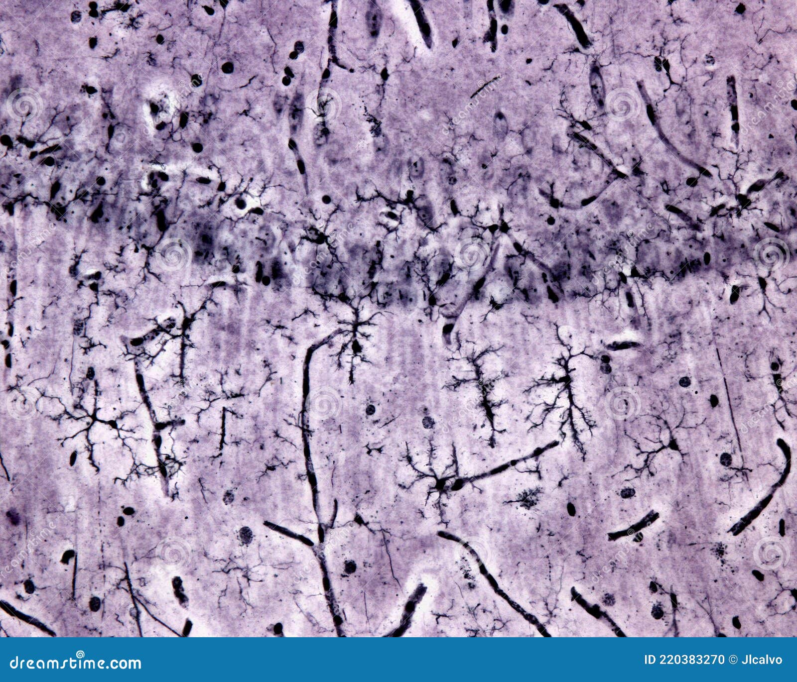 Microglia Cells. Silver Carbonate Stock Photo - Image of method ...