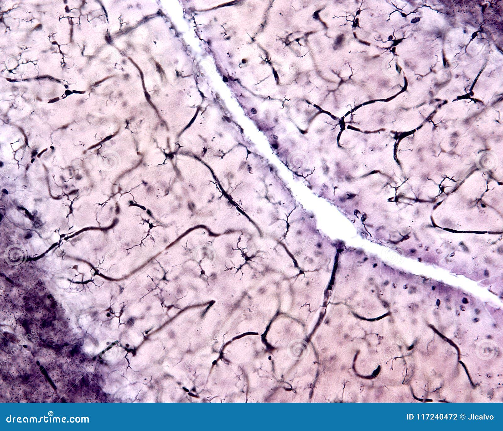 Microglia. Cerebellar Cortex Stock Photo - Image of neuroscience ...