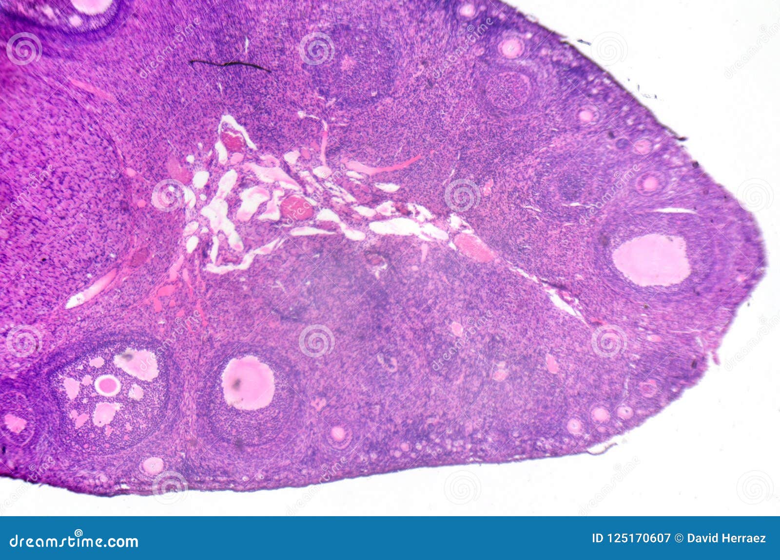 Micrograaf Die Van Eierstok Fundamentele, Primaire En Secundaire FO ...