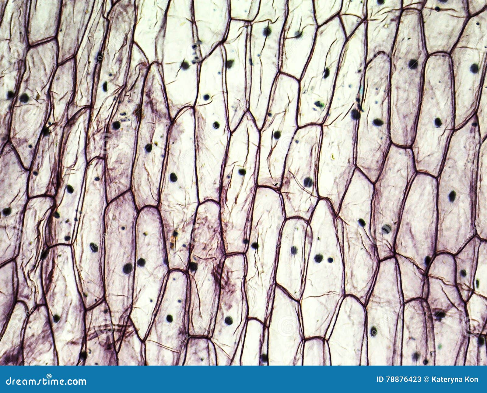 Micrograaf Van Ui Epidermale Cellen Stock Afbeelding - Image of ...