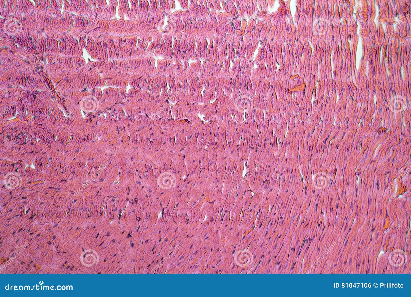 Micrografía del corazón foto de archivo. Imagen de detalle - 81047106