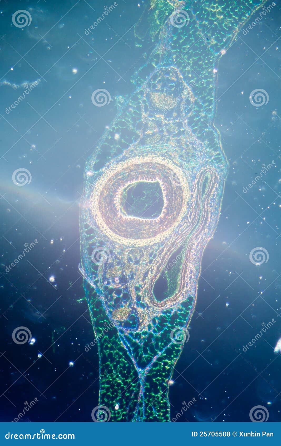 Micrograph of Blood Vessel, Artery Stock Photo - Image of anatomy ...
