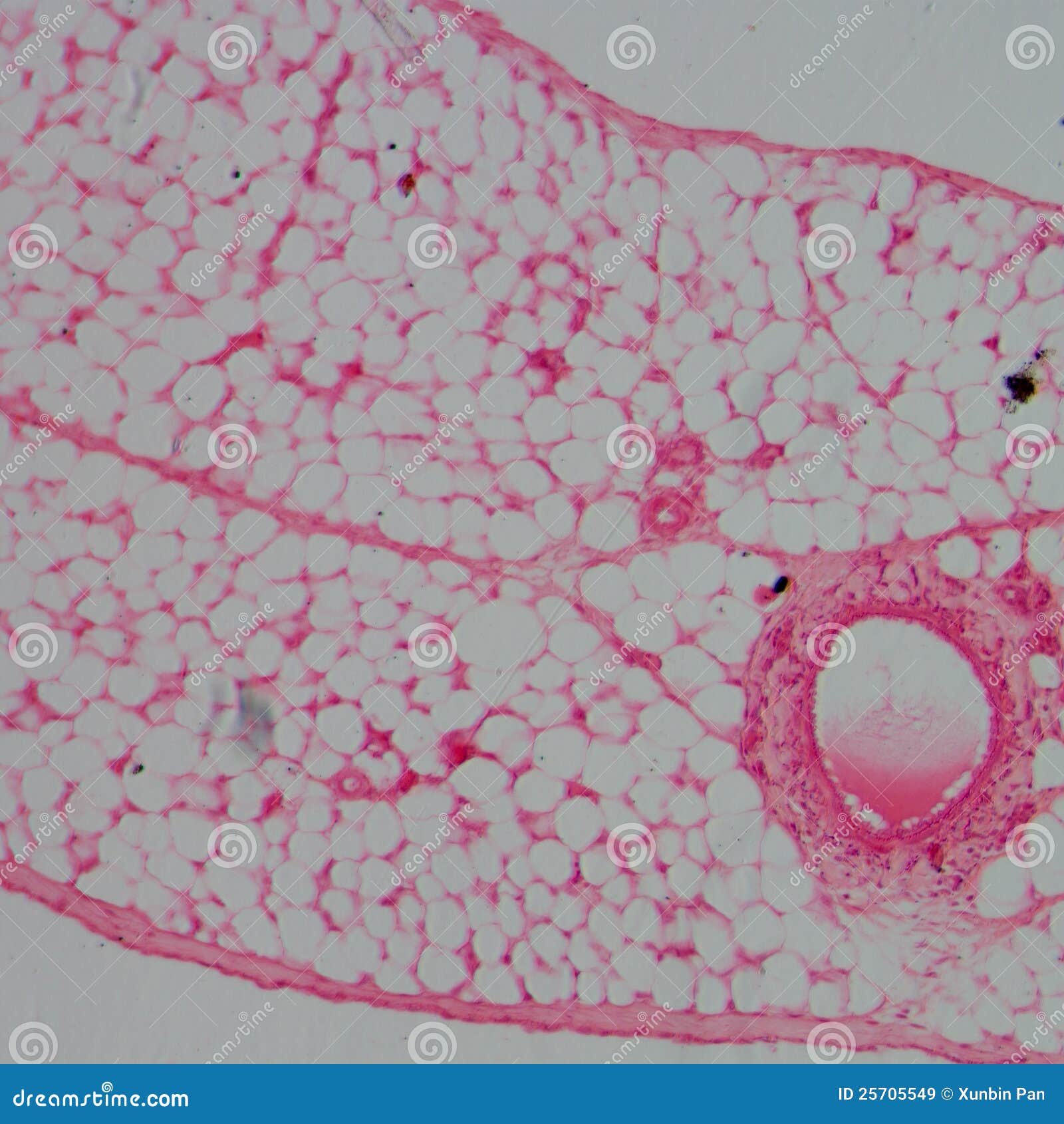Micrograph of Blood Vessel, Artery Stock Image - Image of photograph ...
