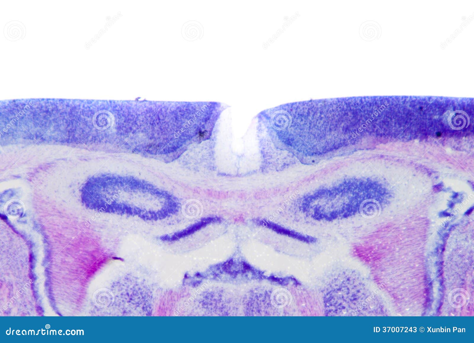 Micrograph of rat brain stock image. Image of immunofluorescent - 37007243