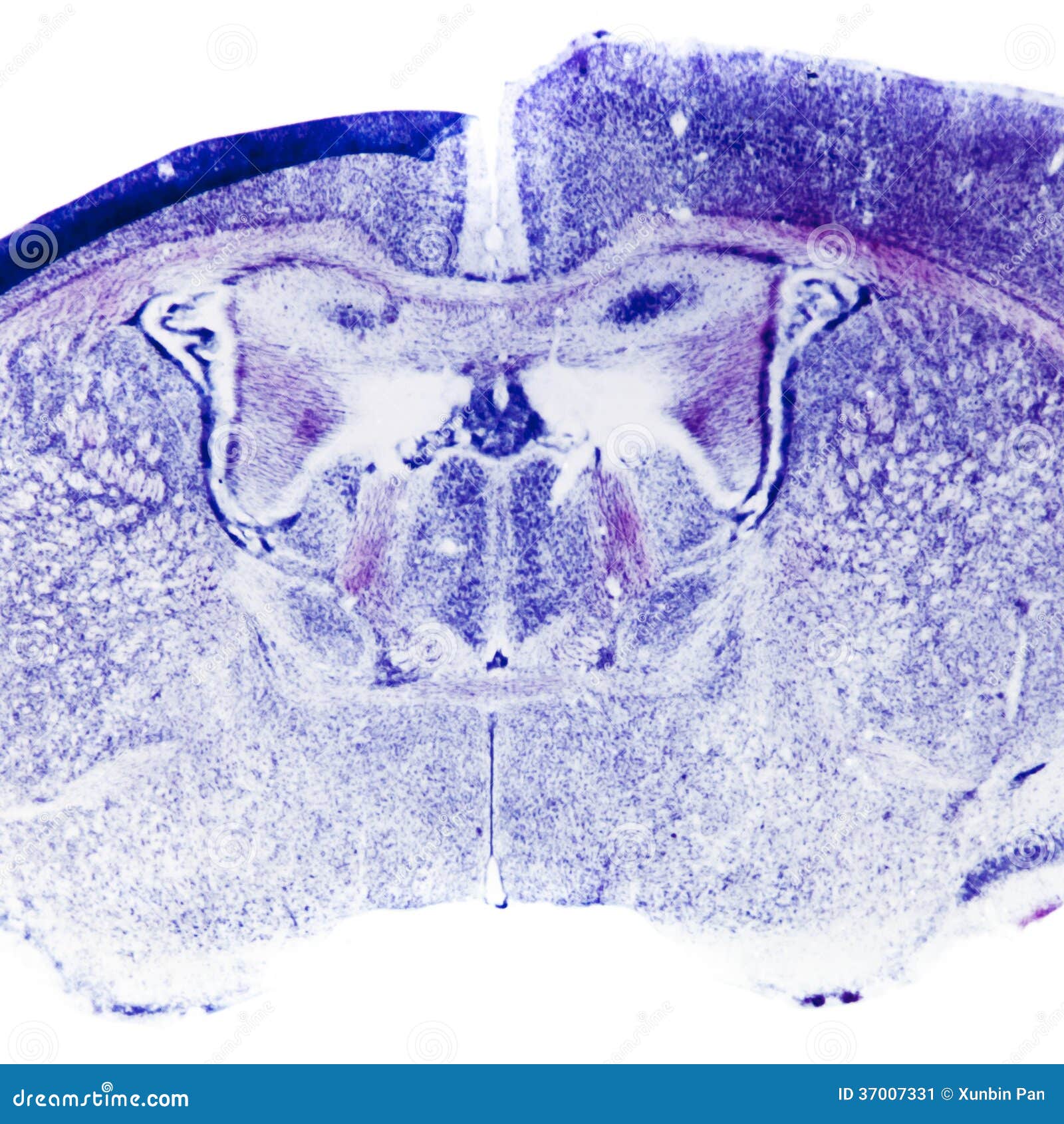 Micrograph of rat brain stock image. Image of cell, microbiology - 37007331