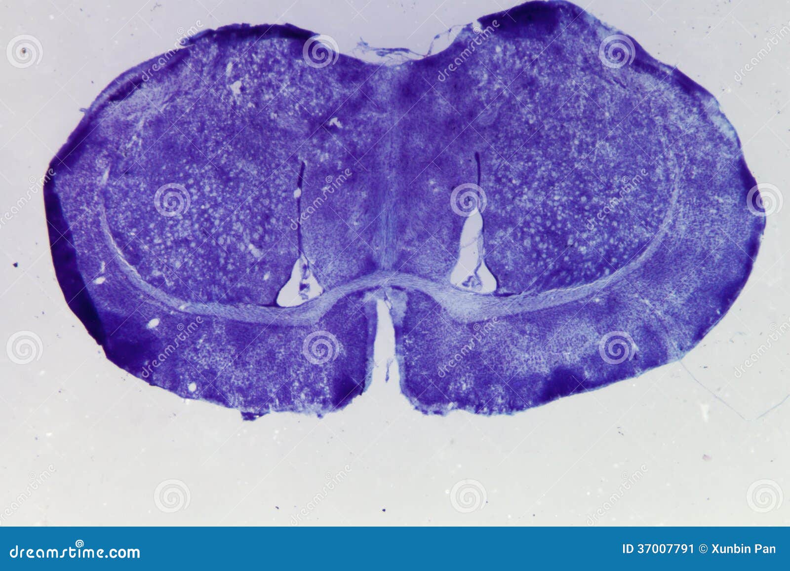 Micrograph of rat brain stock image. Image of receptor - 37007791