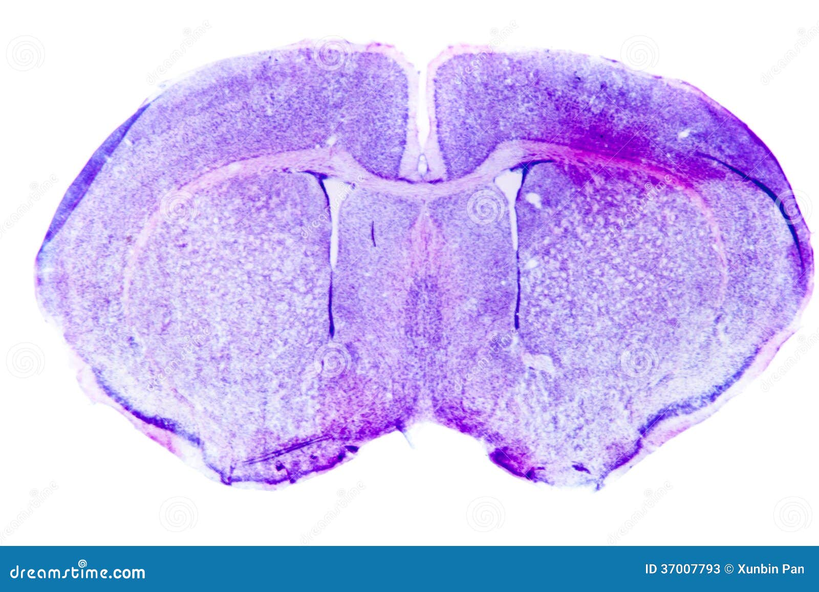Micrograph of rat brain stock image. Image of material - 37007793