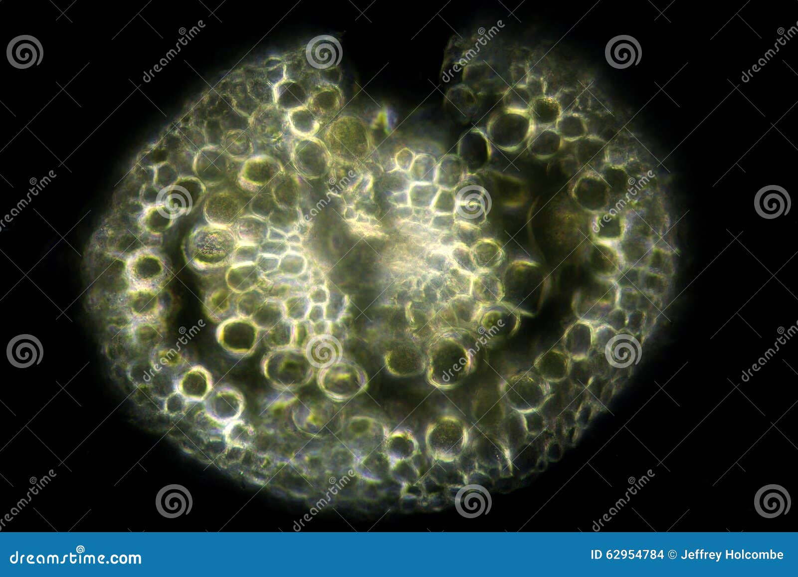 Micrograph of a Seta Cross Section in Polytrichum Moss. Stock Photo ...