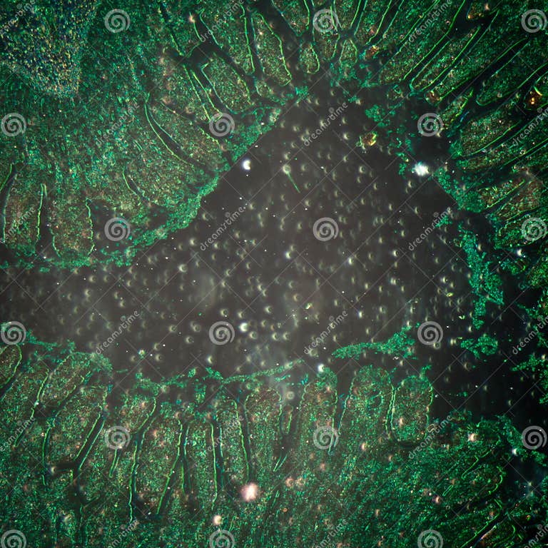 Micrograph of Small Intestinum Stock Image - Image of macro, physiology ...