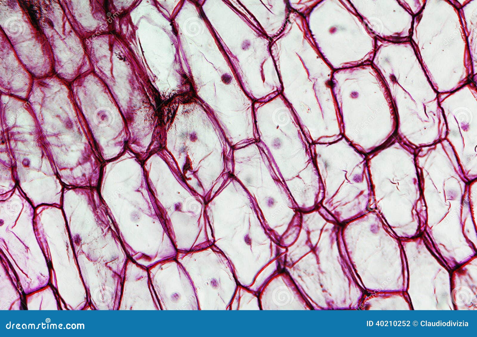 Micrographe D'epidermus D'oignon Photo stock - Image du effectué ...