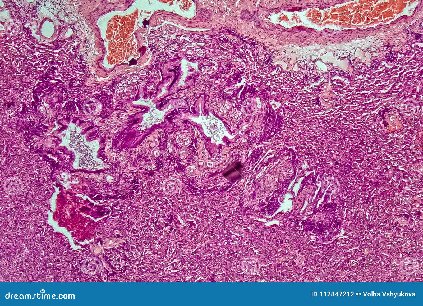 Cross-section of Rat Normal Lung Tissue, 60x Zoom Stock Photo - Image ...