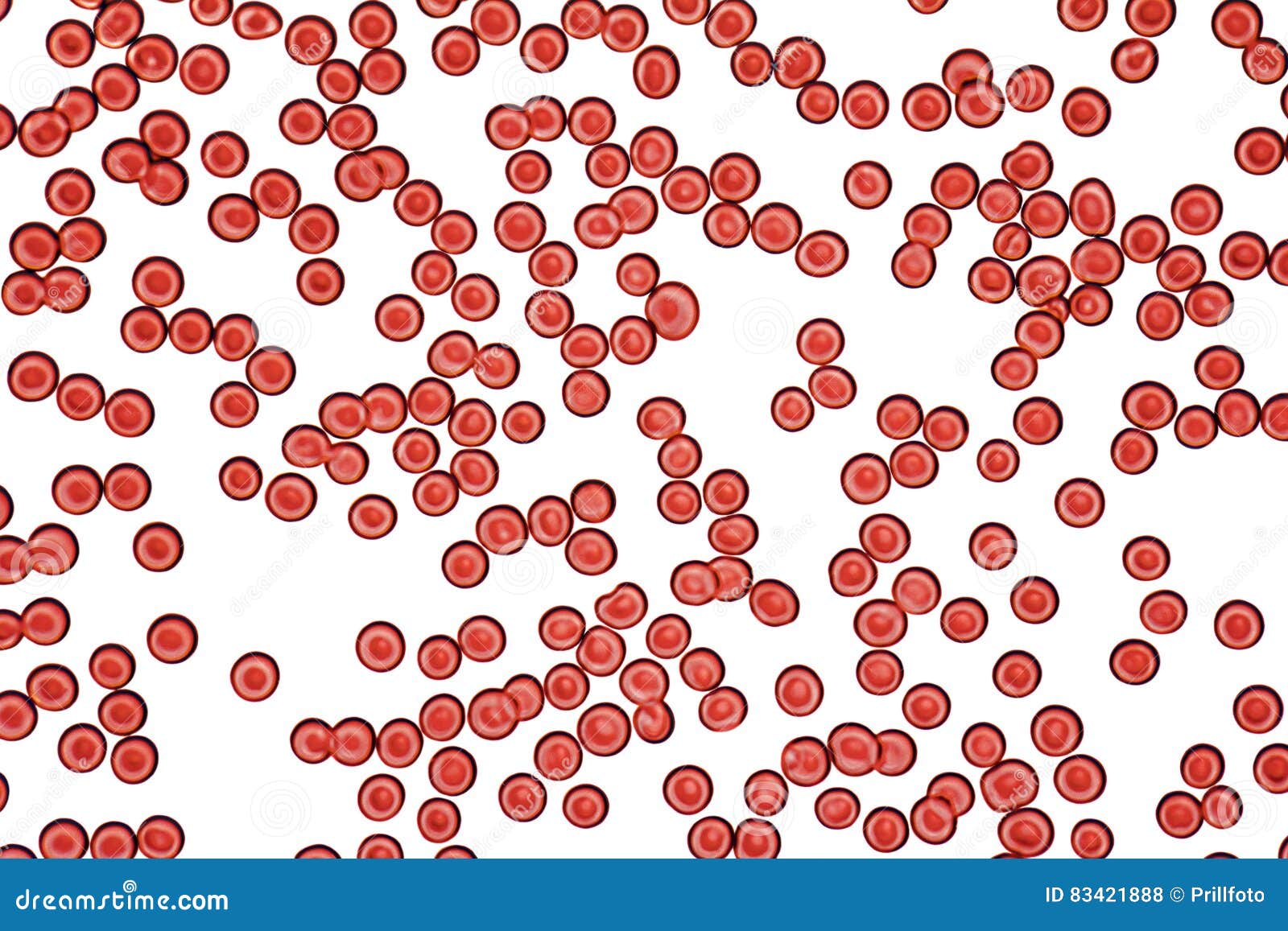 Micrography Van De Bloedcel Stock Foto - Image of biologie, rood: 83421888