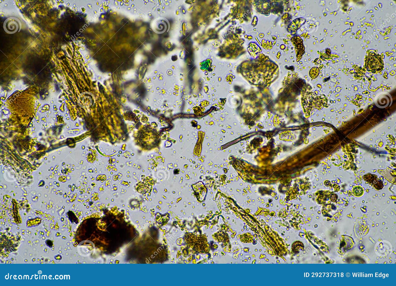 Microorganisms and Biology in Compost and Soil Sample Under the ...
