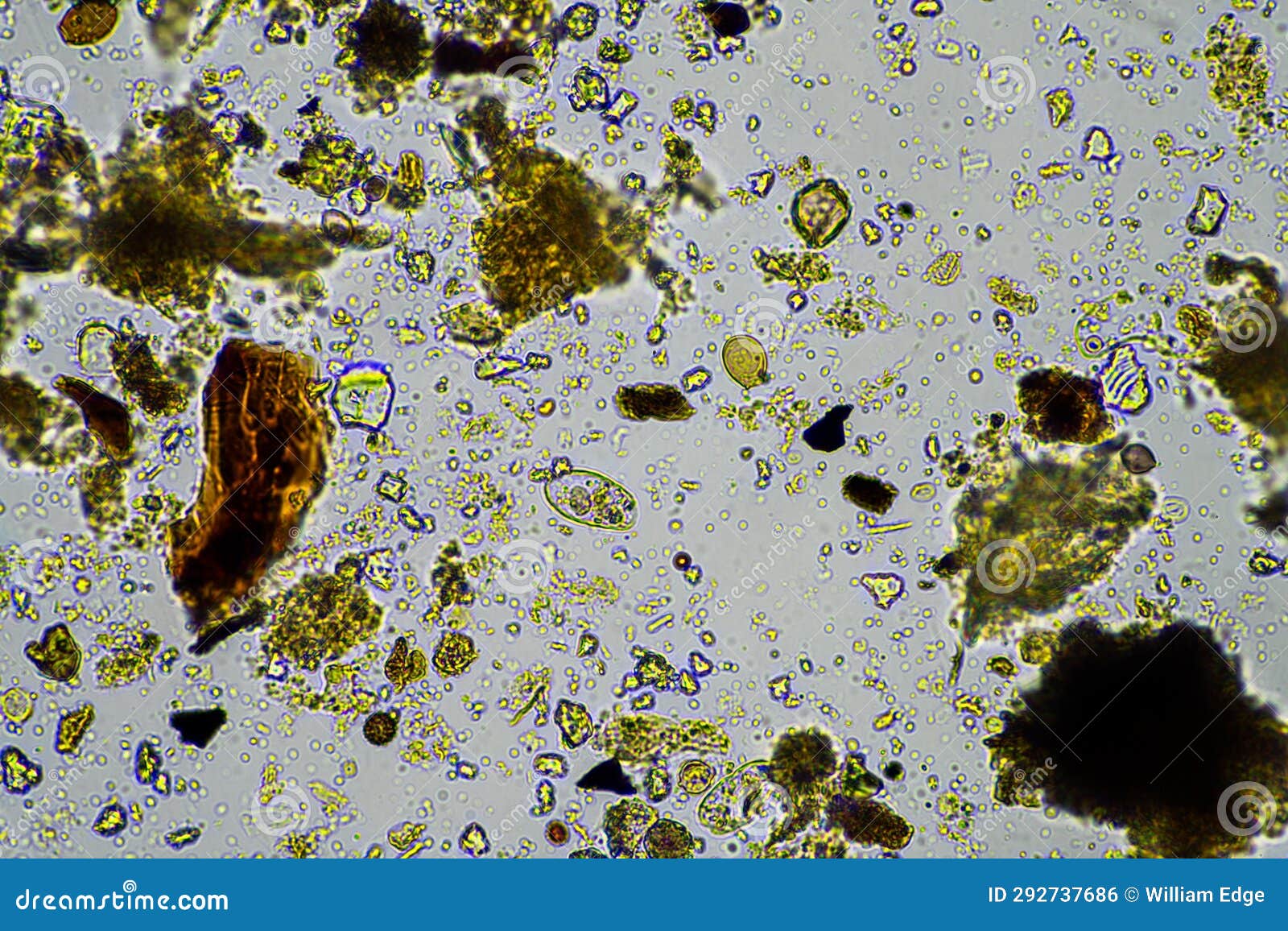 Microorganisms and Biology in Compost and Soil Sample Under the ...