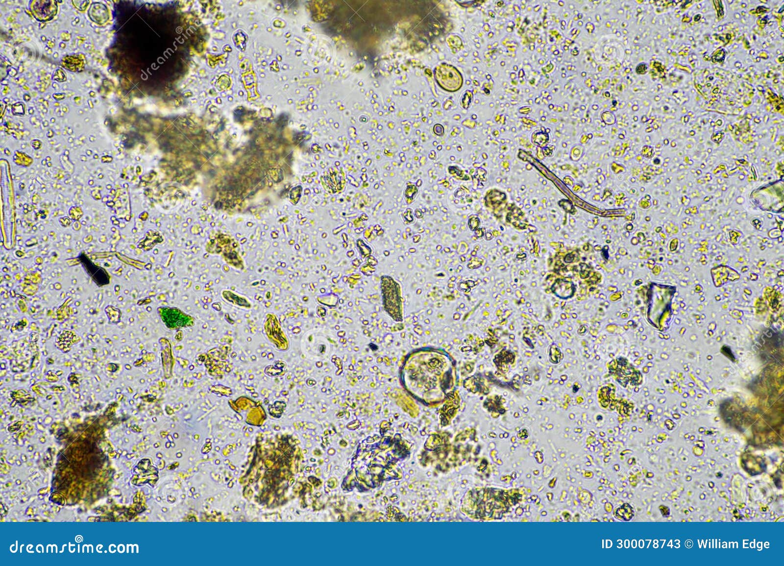 Microorganisms And Biology In Compost And Soil Sample Under The ...