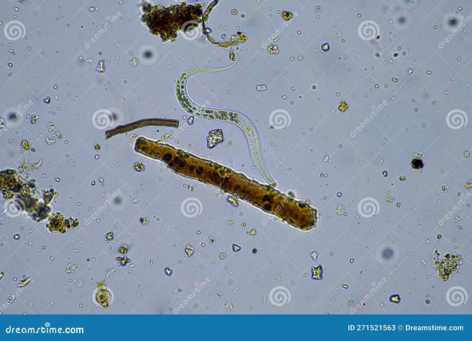 Microorganisms and Biology in Compost and Soil Sample Under the ...