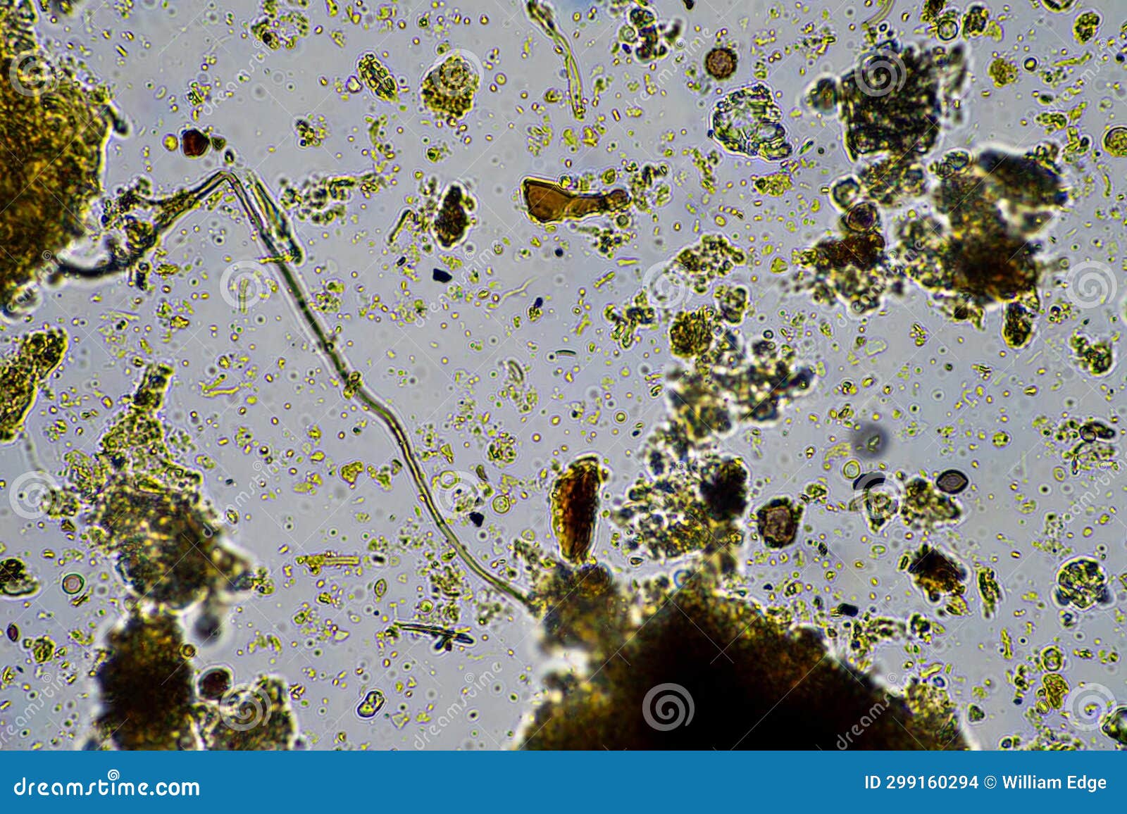 Microorganisms and Biology in Compost and Soil Sample Under the ...