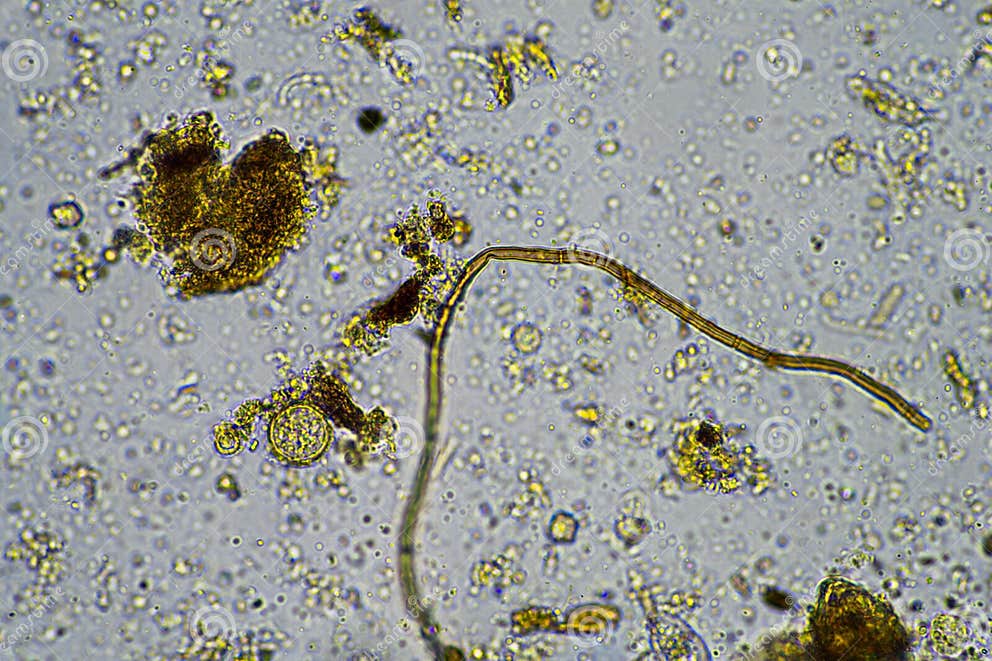 Microorganisms and Biology in Compost and Soil Sample Under the ...