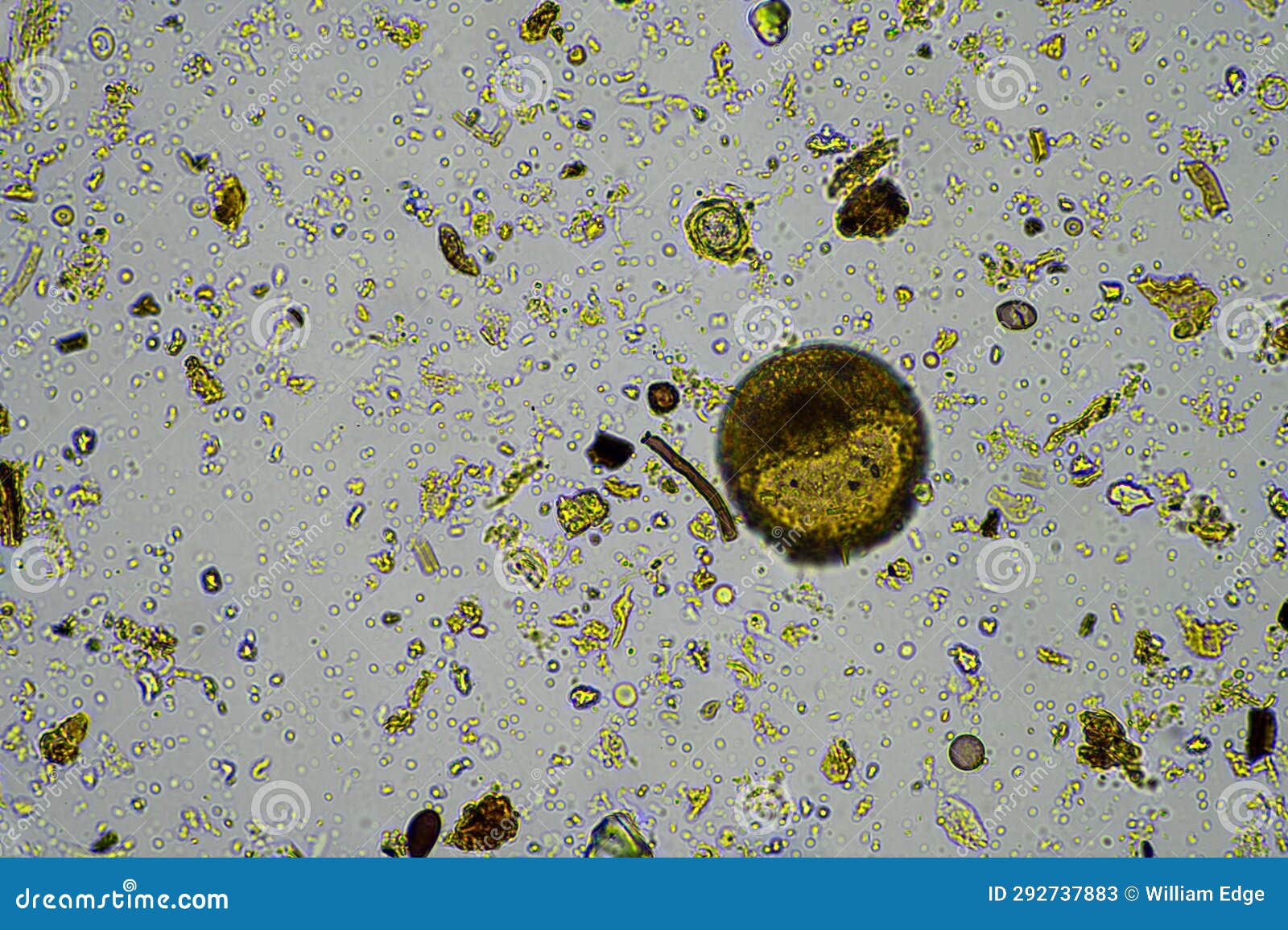 Microorganisms and Biology in Compost and Soil Sample Under the ...