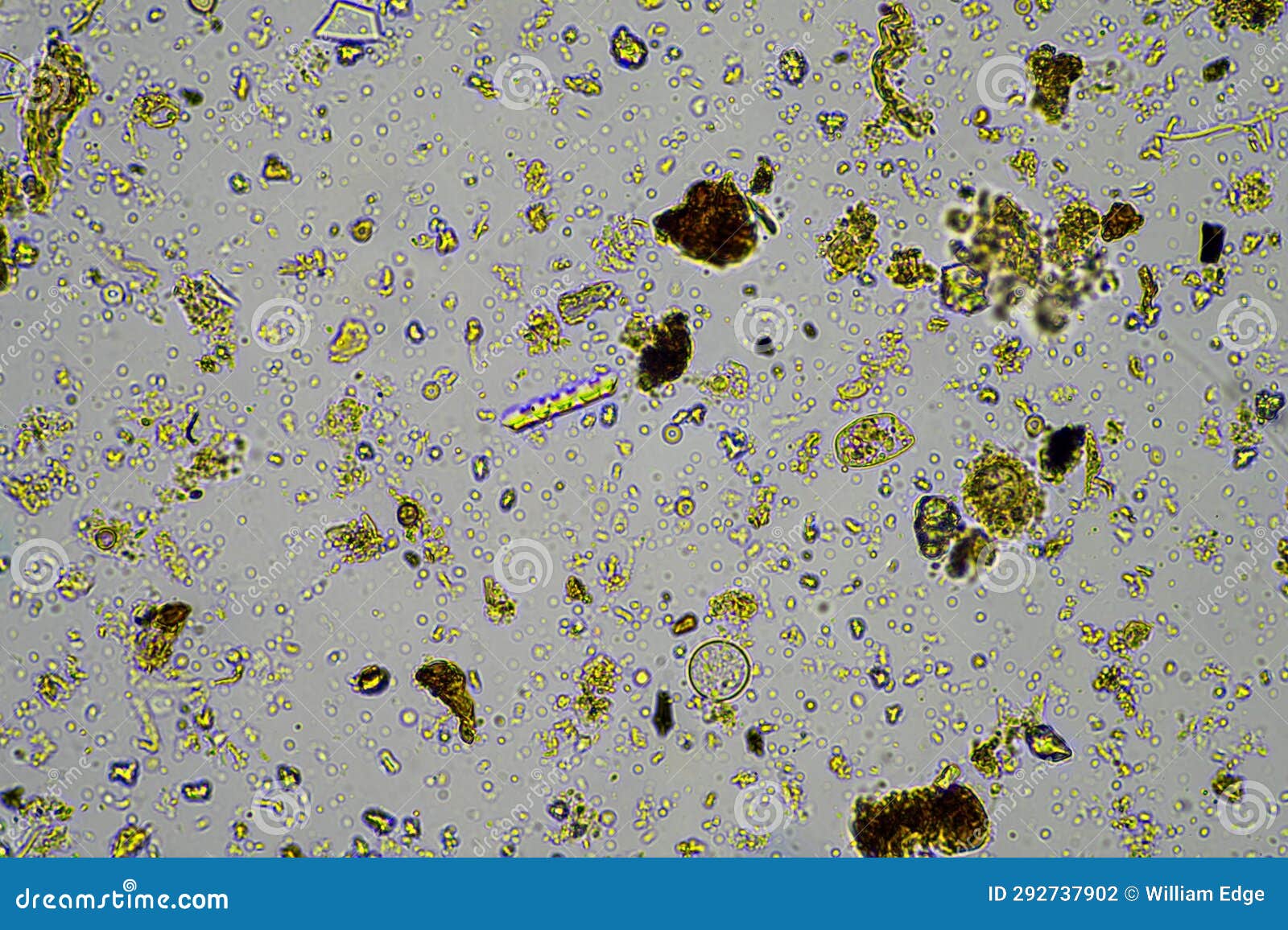 Microorganisms and Biology in Compost and Soil Sample Under the ...