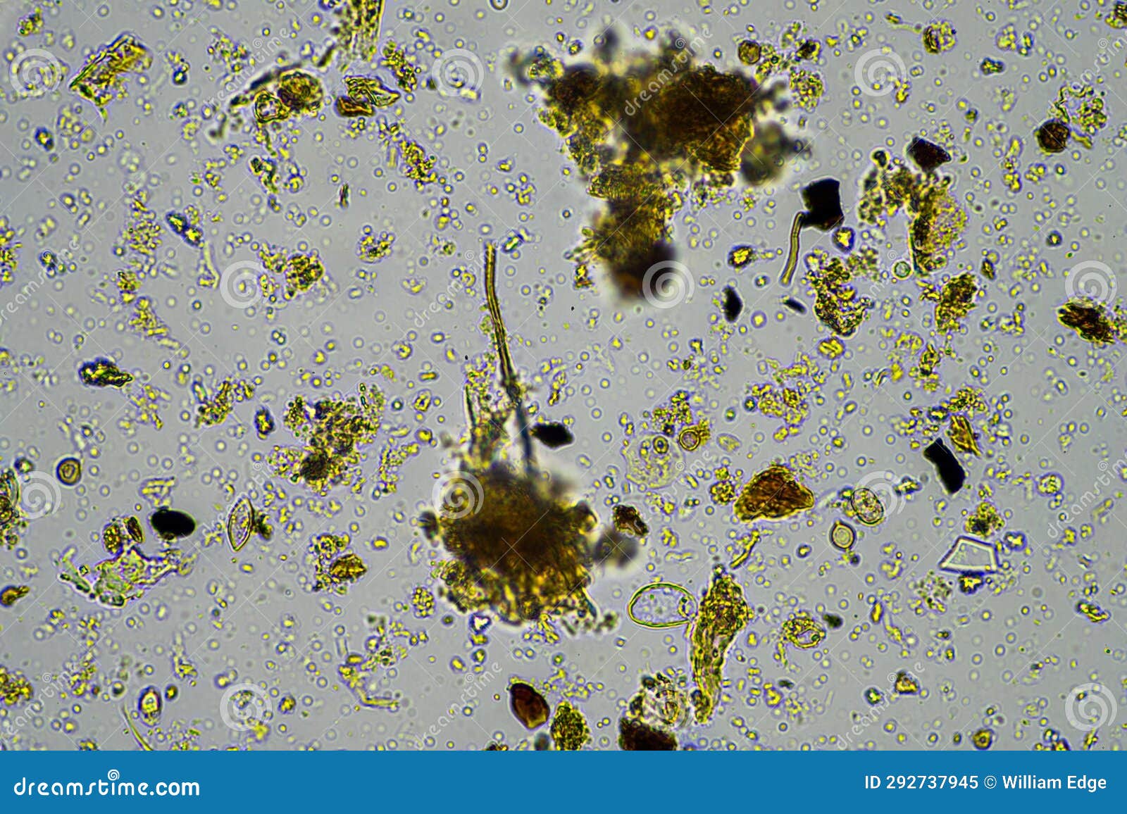 Microorganisms And Soil Biology, With Nematodes And Fungi Under The ...