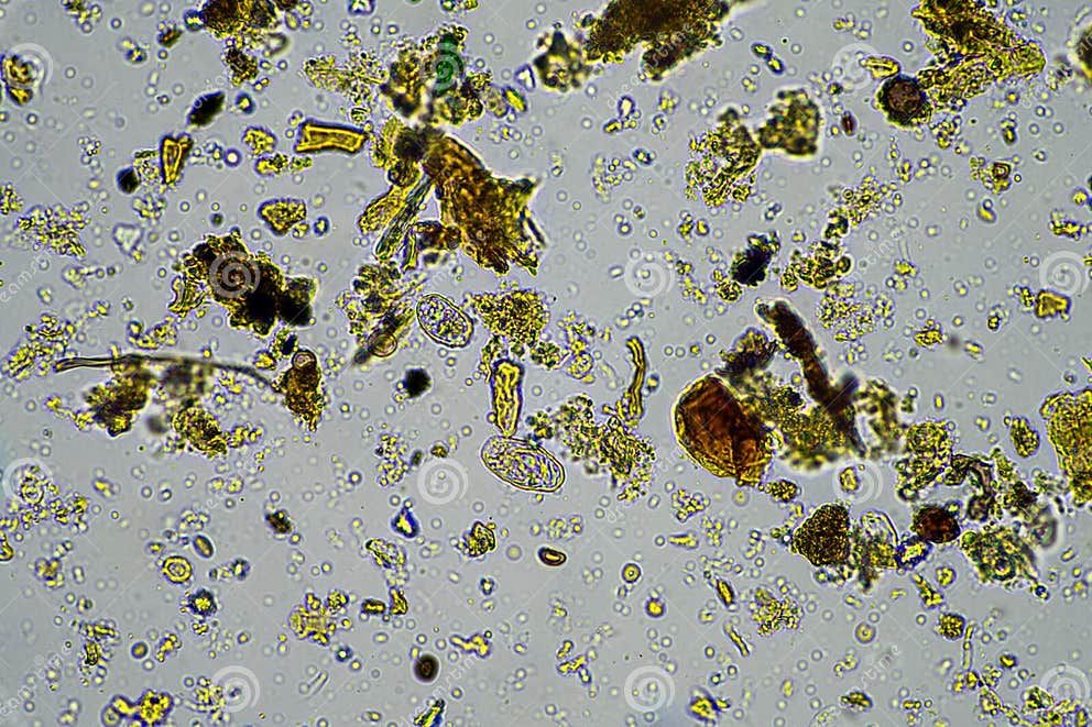 Microorganisms and Biology in Compost and Soil Sample Under the ...