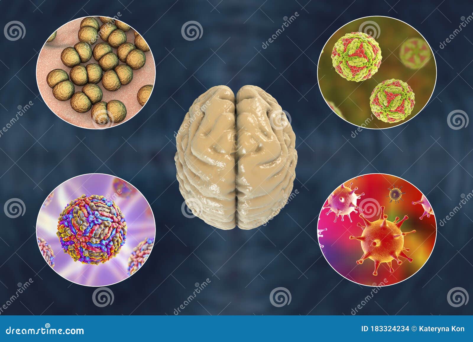 Microorganisms that Cause Brain Infections Stock Illustration ...