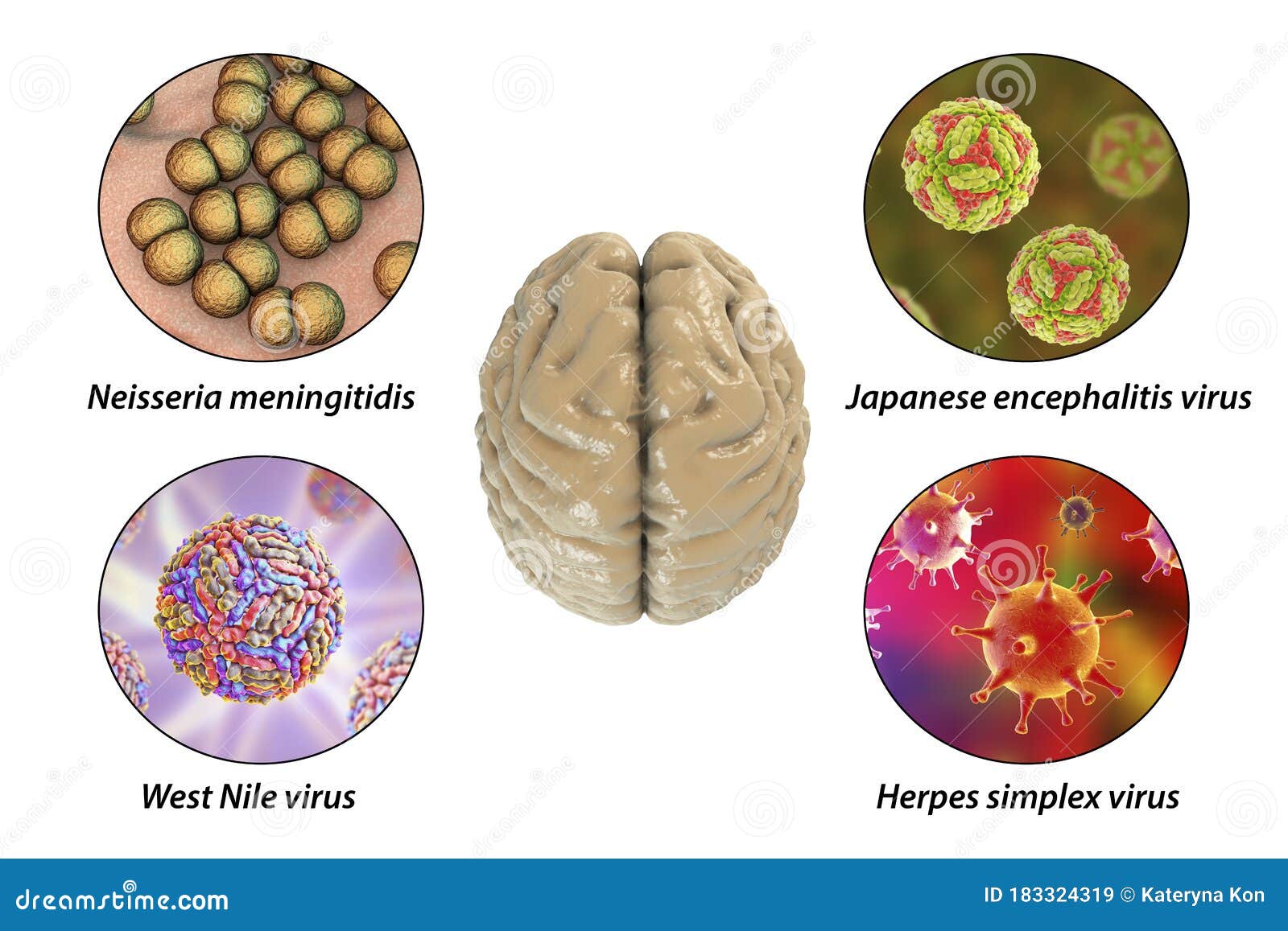 Microorganisms that Cause Brain Infections Stock Illustration ...
