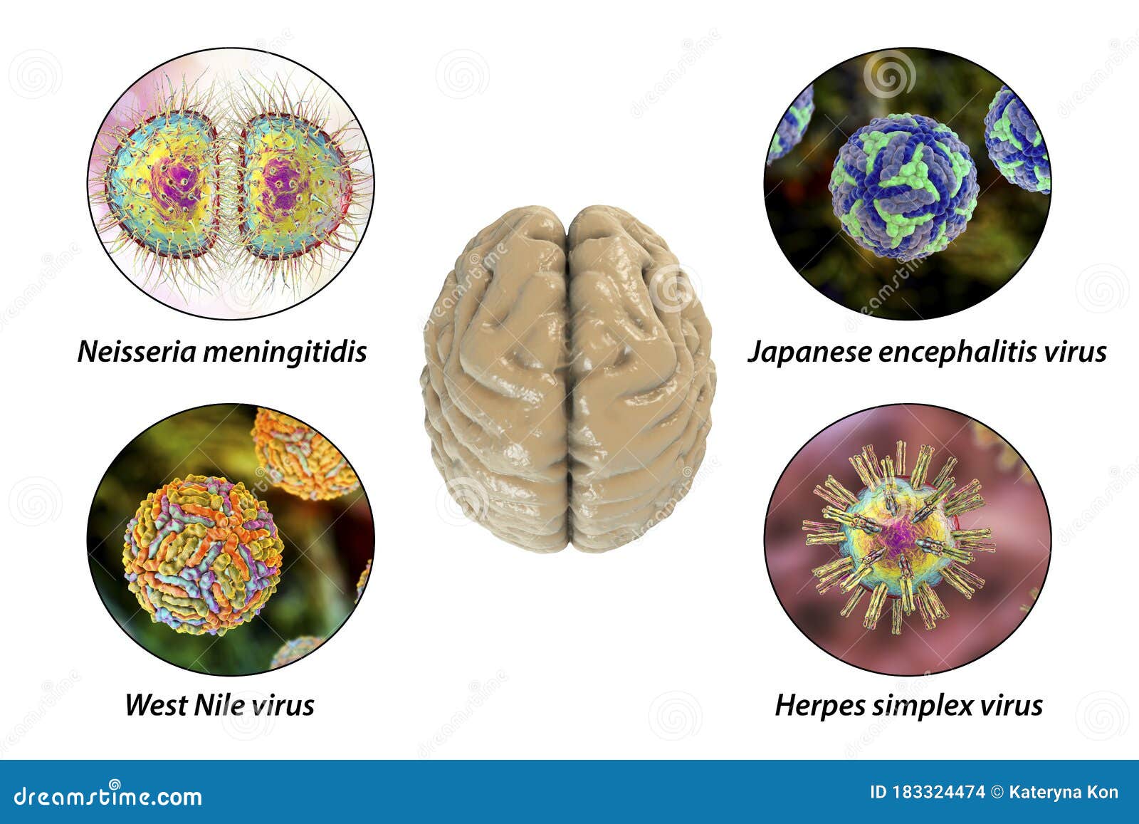 Microorganisms that Cause Brain Infections Stock Illustration ...