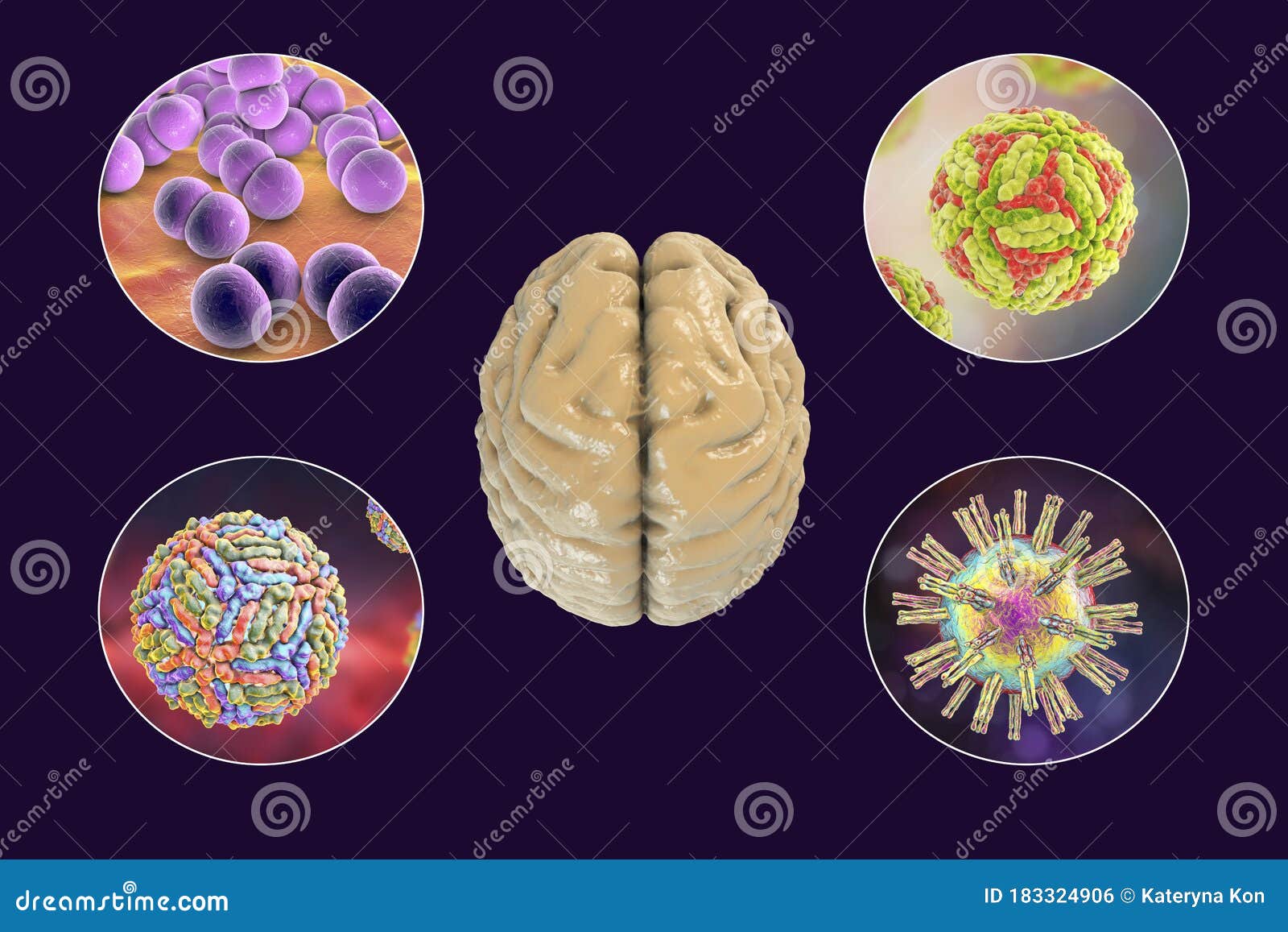 Microorganisms that Cause Brain Infections Stock Illustration ...