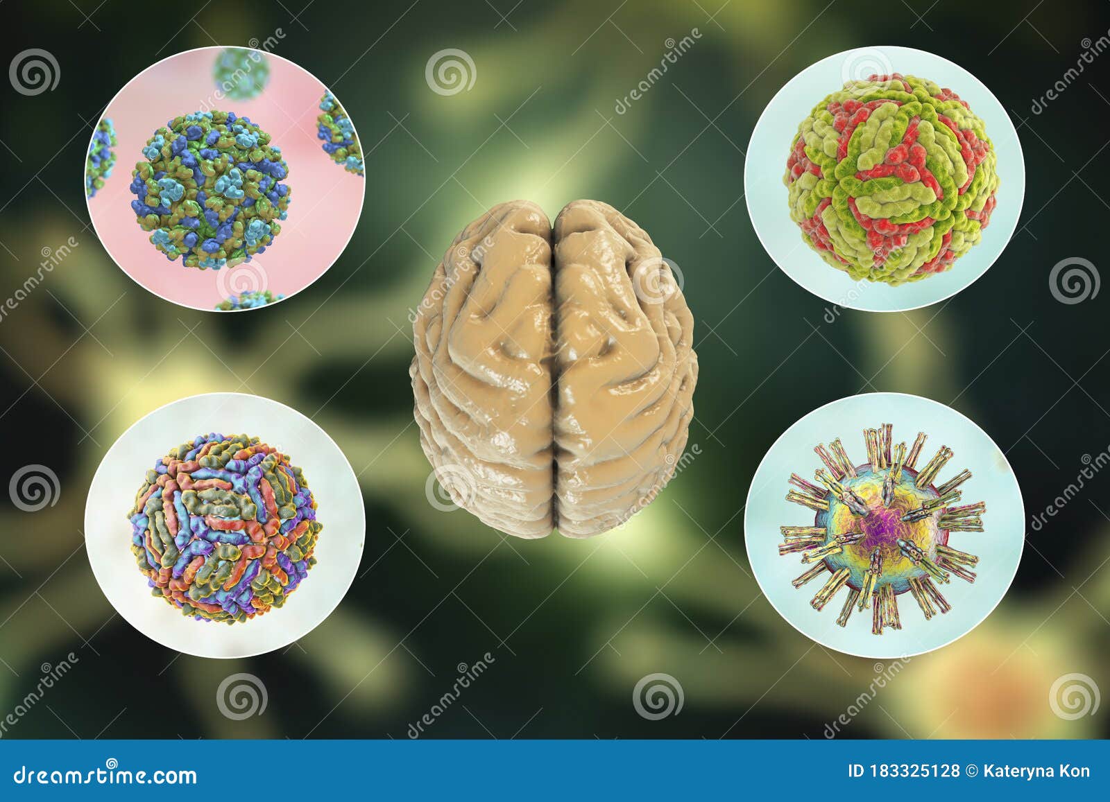 Microorganisms that Cause Brain Infections Stock Illustration ...