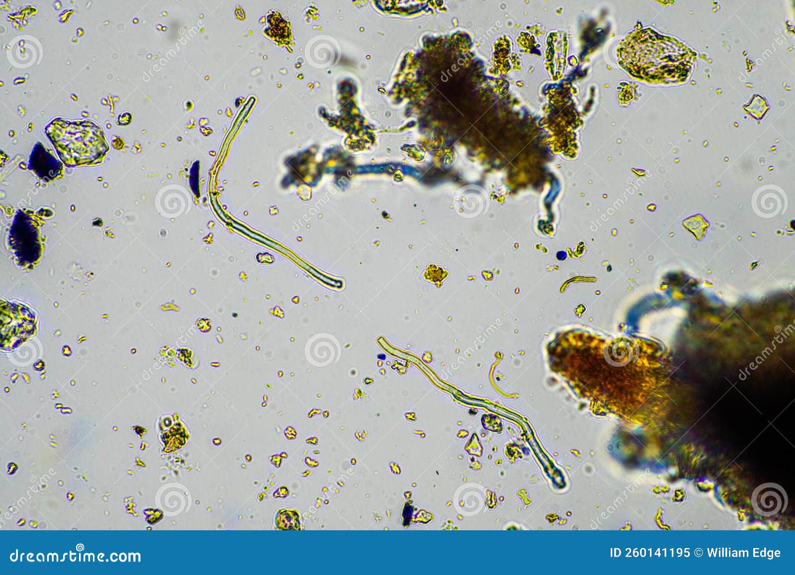 Microorganisms and Soil Biology, with Nematodes and Fungi Under the ...