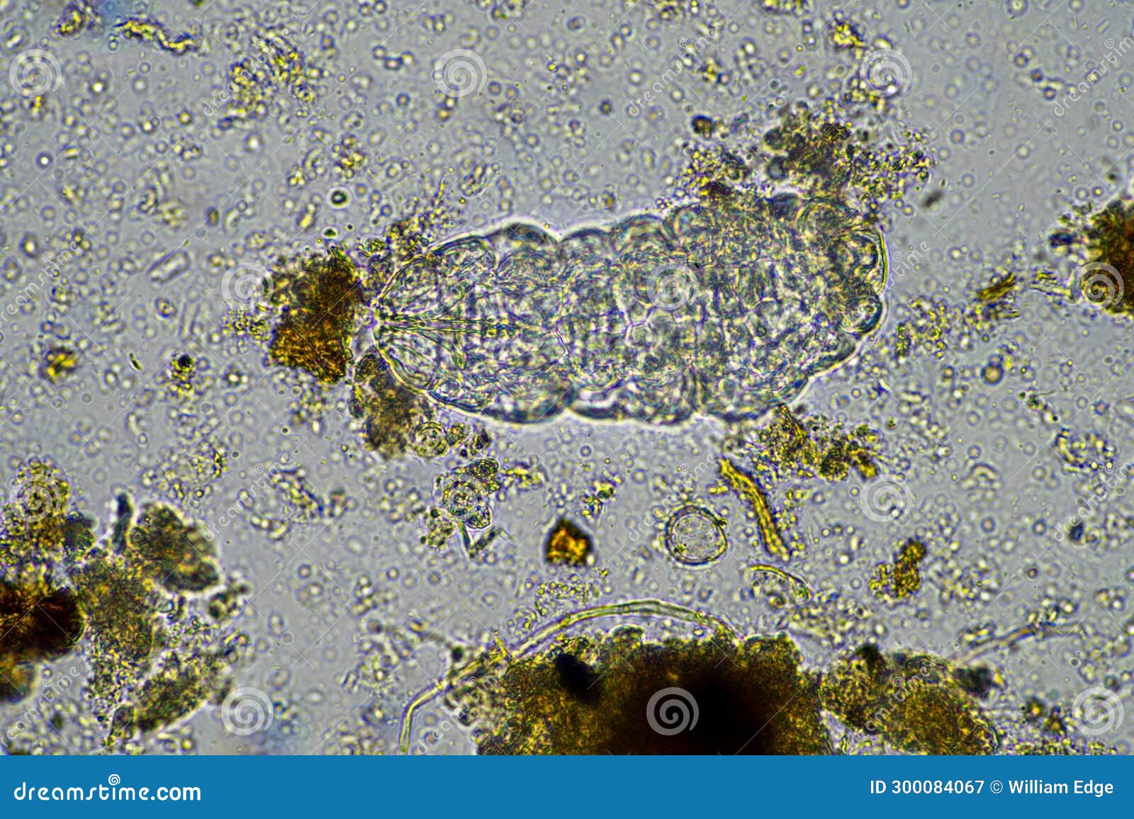 Microorganisms And Soil Biology, With Nematodes And Fungi Under The ...