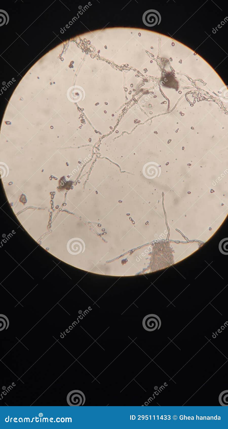 Microorganisms in urine stock image. Image of awsome - 295111433