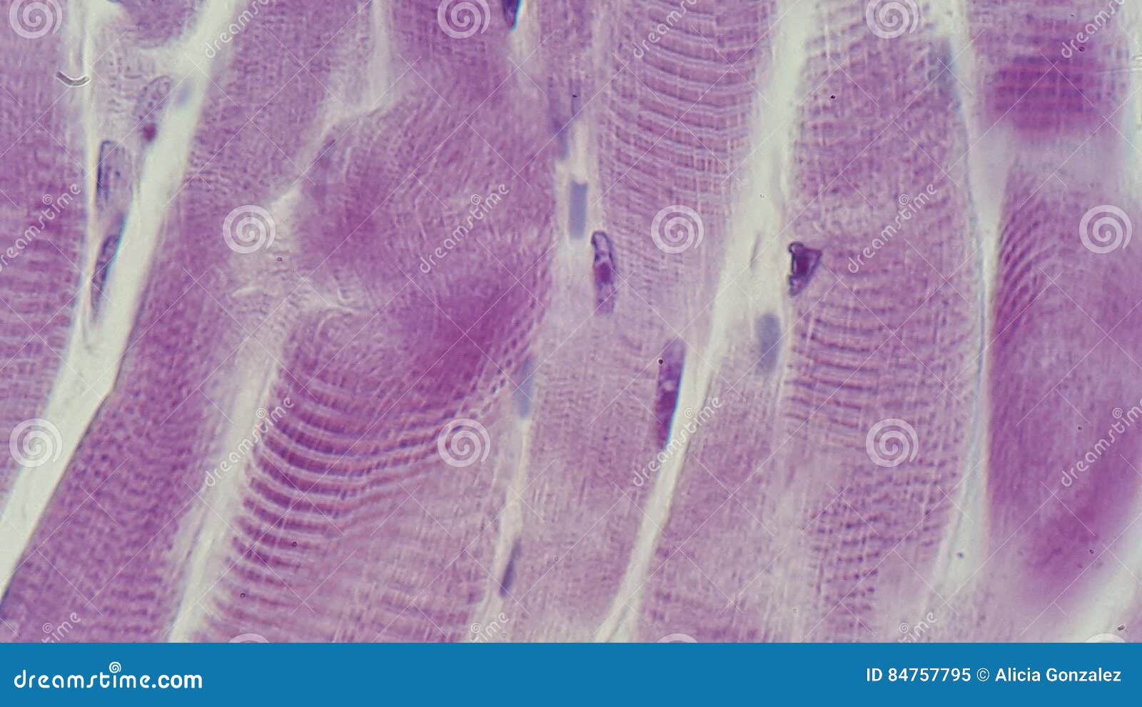 Microphotography Striated Muscle Stock Image - Image of ...
