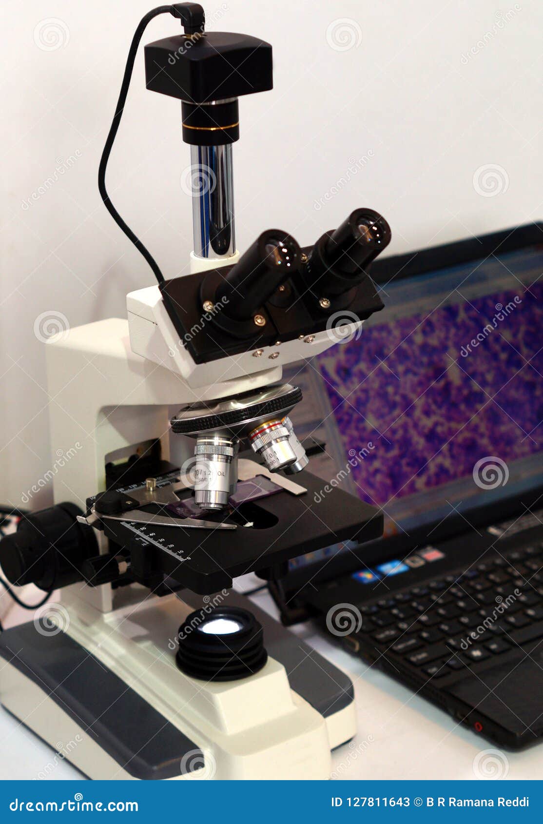 Microscope for Analysis of Sample of Patients in Hospita Stock Image ...