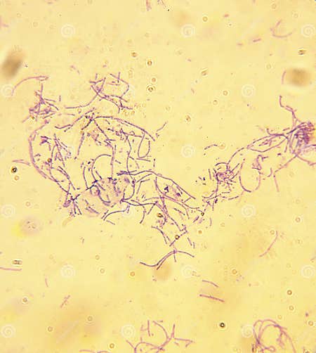 Microscope-Anthrax-Bacillus Anthracis Stock Photo - Image of anthracis ...