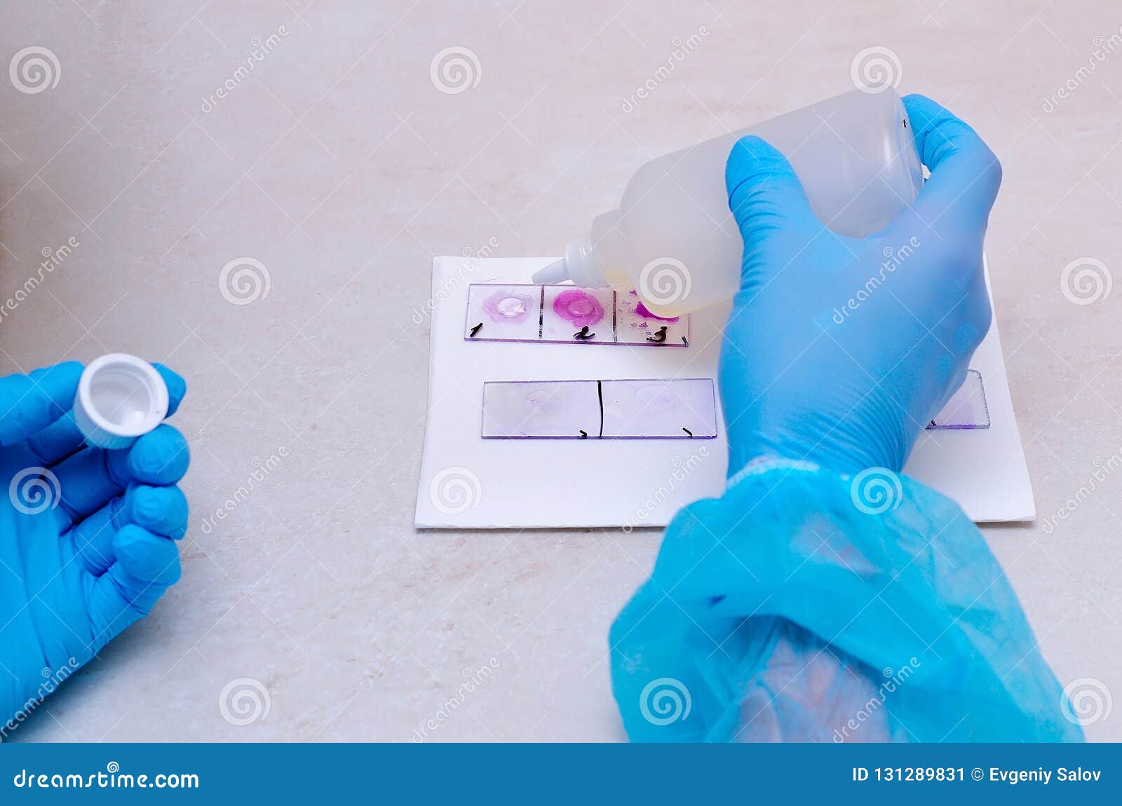 Microscope. Microbiological Laboratory. Mold and Fungal Cultures ...