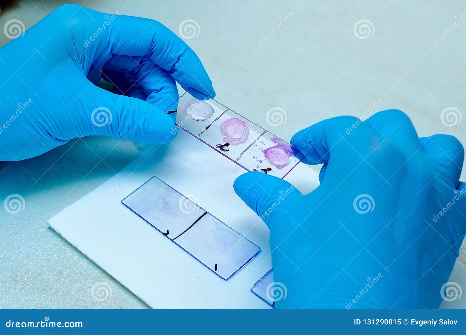Microscope. Microbiological Laboratory. Mold and Fungal Cultures ...