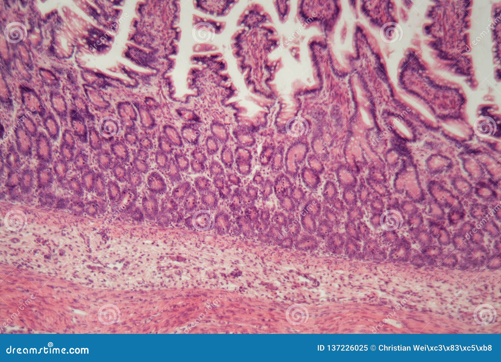 Large Intestine With Diverticular Tissue Royalty-Free Stock Image ...