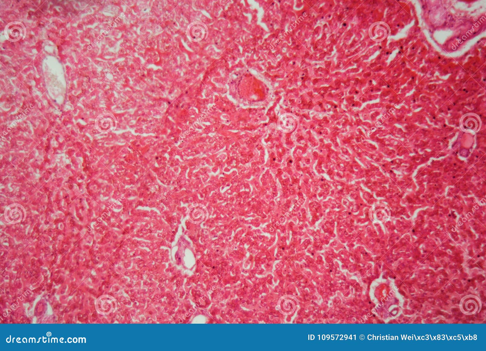 Liver Cells Under the Microscope Stock Image - Image of deposit ...