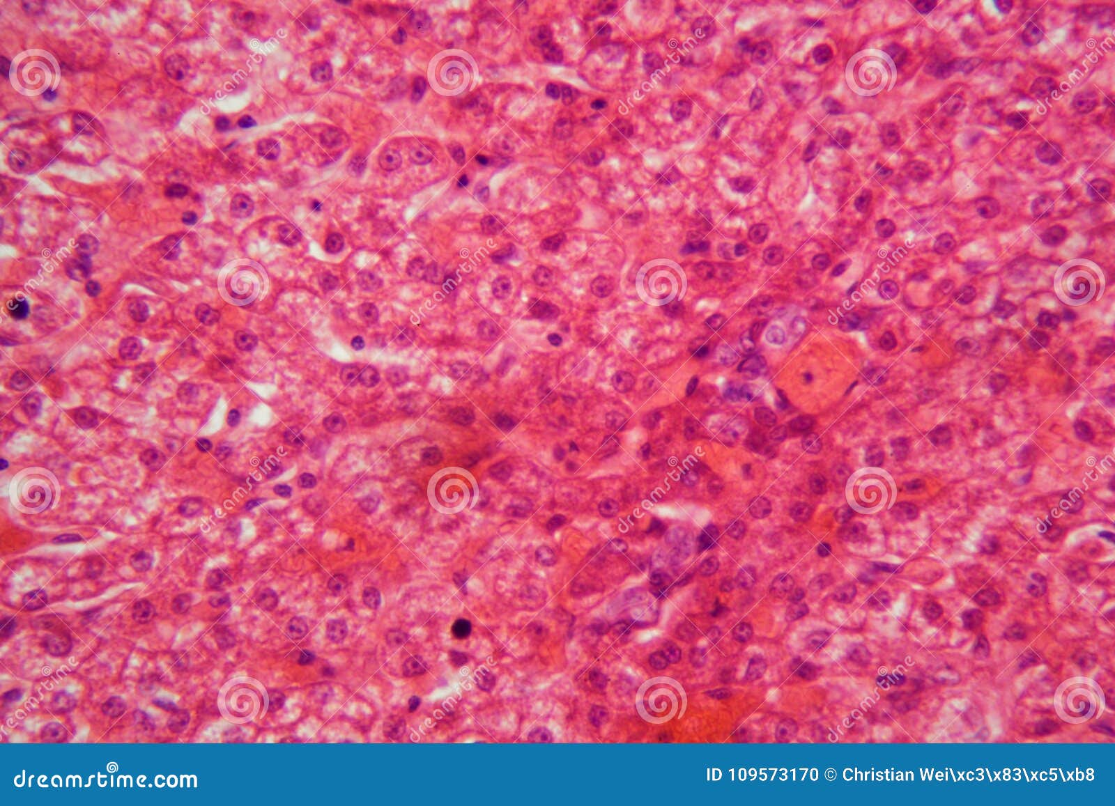 Liver Cell Under Microscope