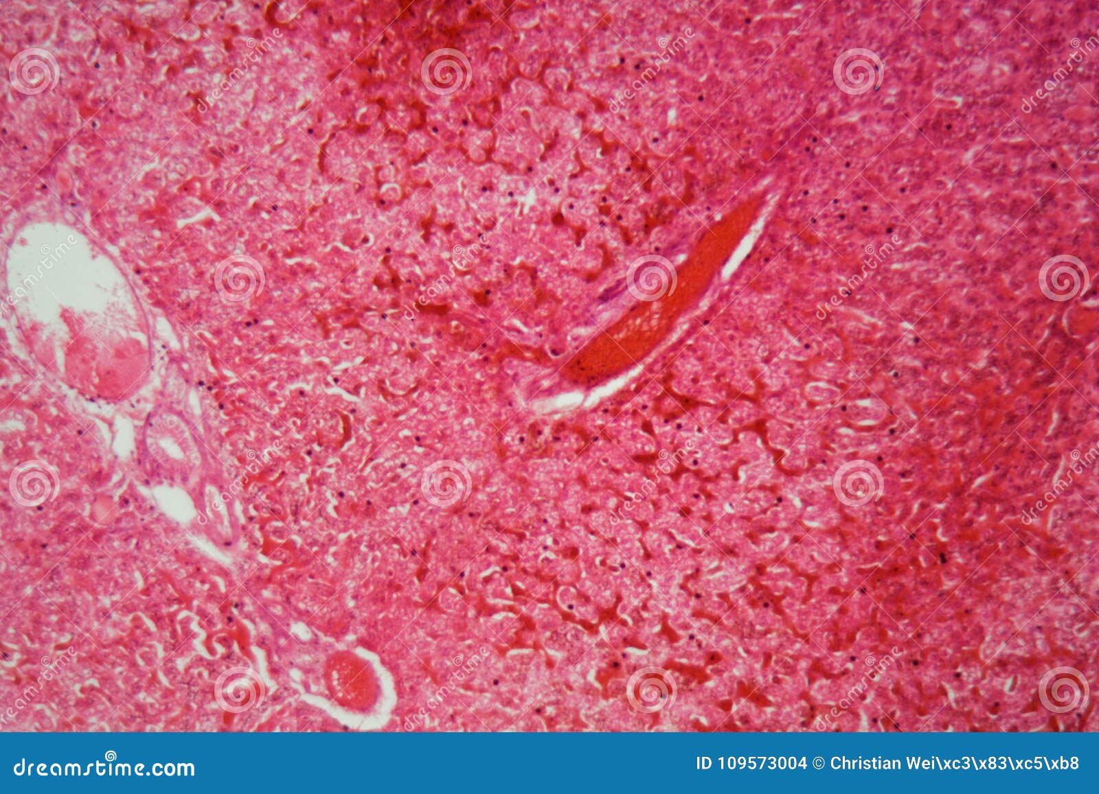 Liver Cells Under the Microscope Stock Photo - Image of health ...