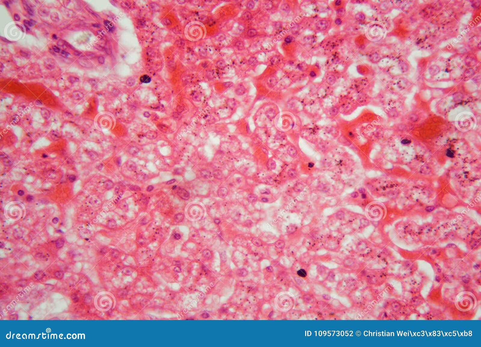 Human Liver Cells Under Microscope