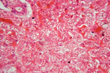 Liver Cells Under the Microscope Stock Photo - Image of cellular ...