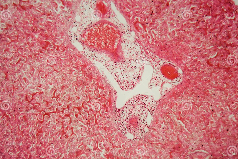 Liver Cells Under the Microscope Stock Photo - Image of hepatic ...