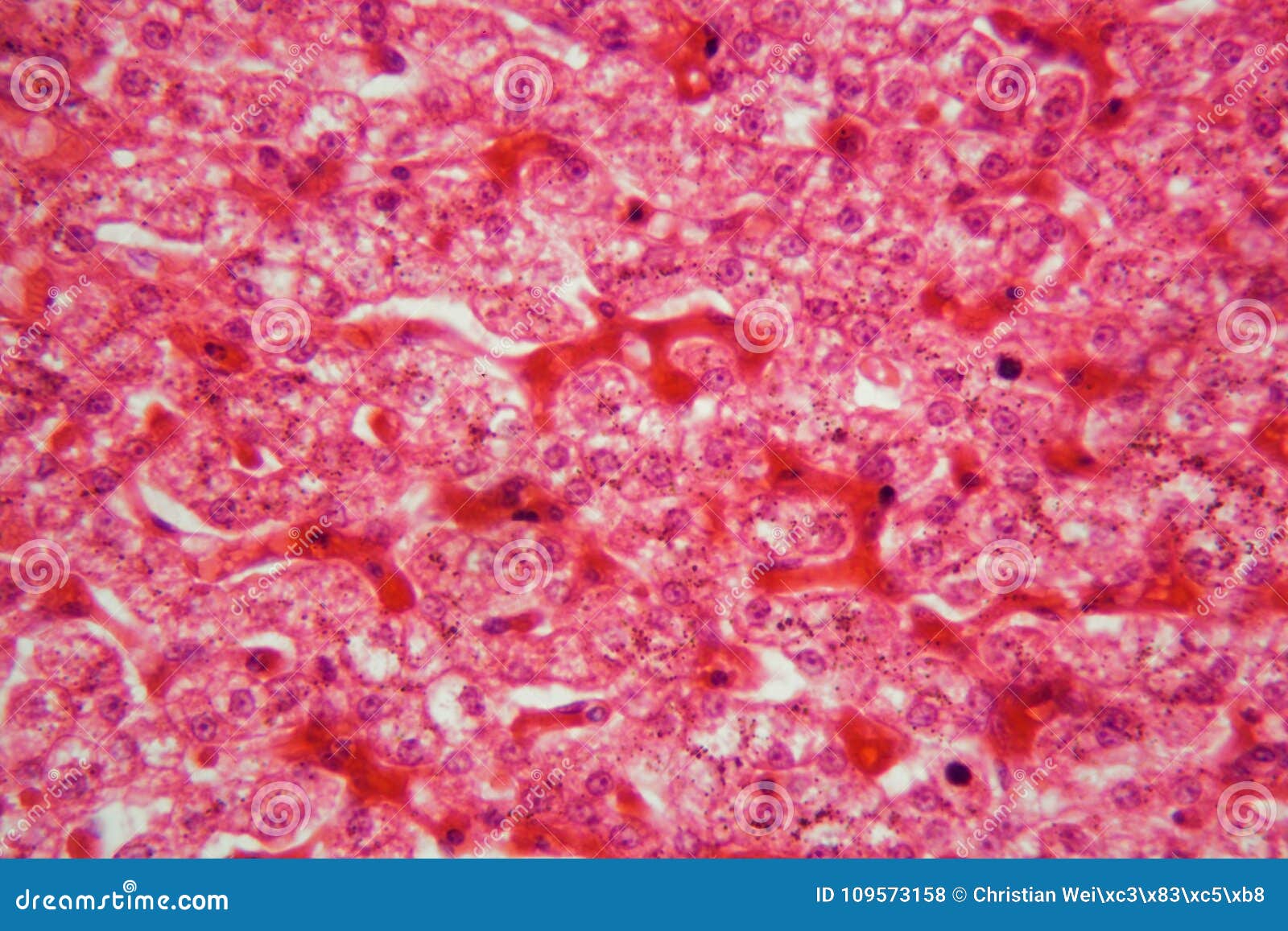 Liver Cells Under the Microscope Stock Photo - Image of histology ...
