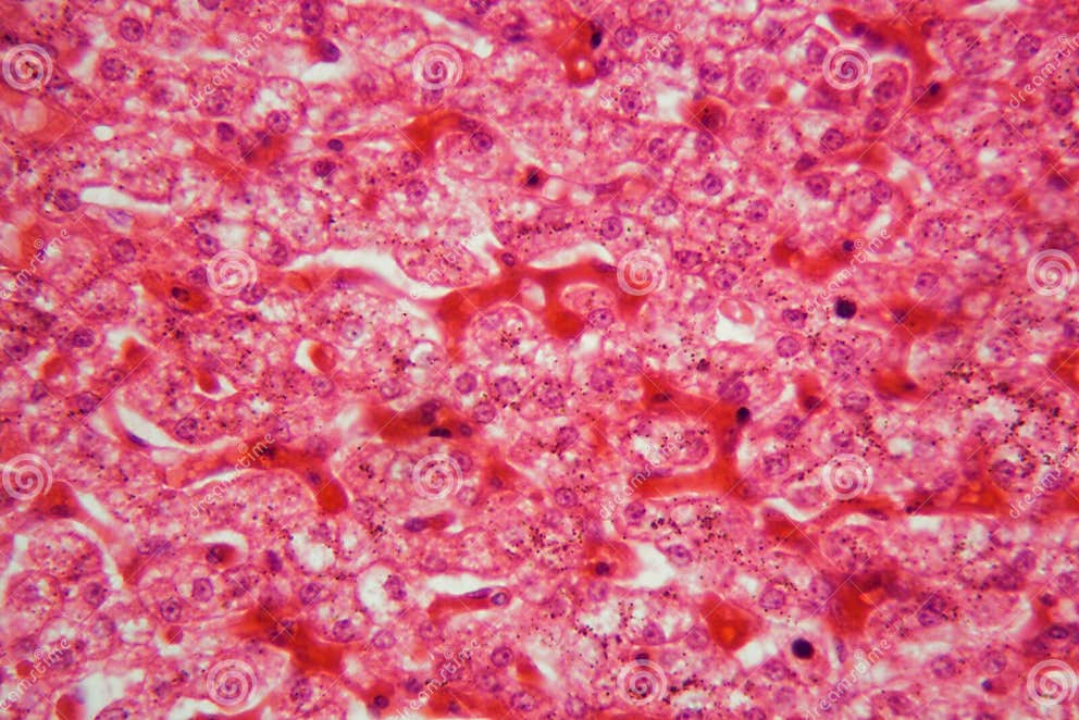 Liver Cells Under the Microscope Stock Photo - Image of histology ...