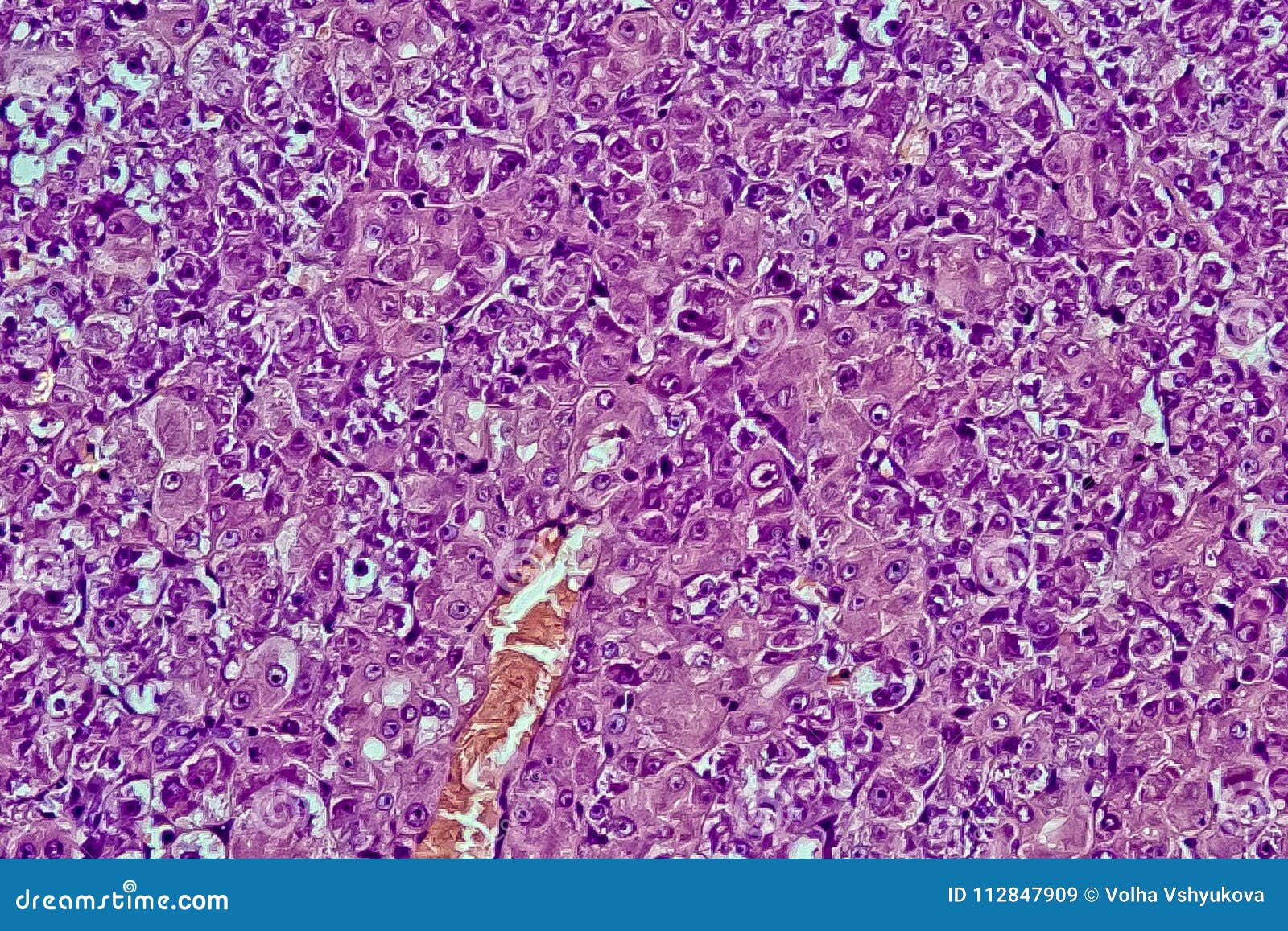 Microscope Photo of a Section through a Rat Liver, 60x Zoom Stock Image ...